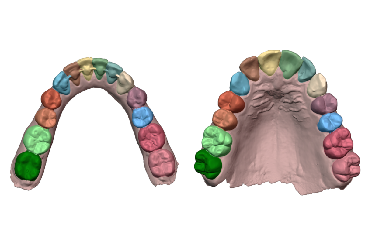 KI-gestützte Kieferorthopädische Diagnose und Planungsplattform – DASU ...